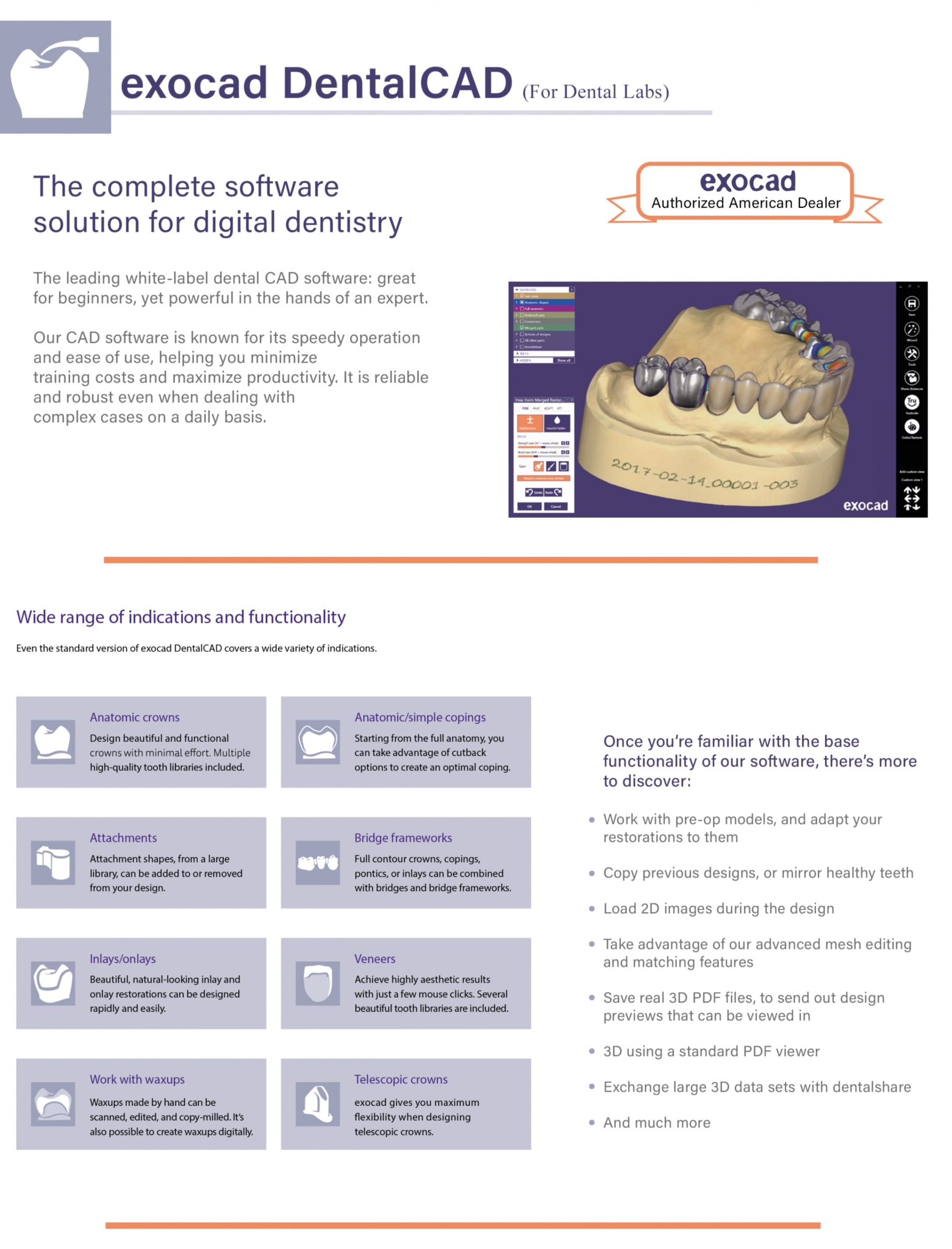 Experience Precision dentistry with the Exocad Dental CAD software ...